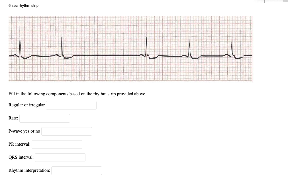 Solved 6 sec rhythm strip Fill in the following components | Chegg.com