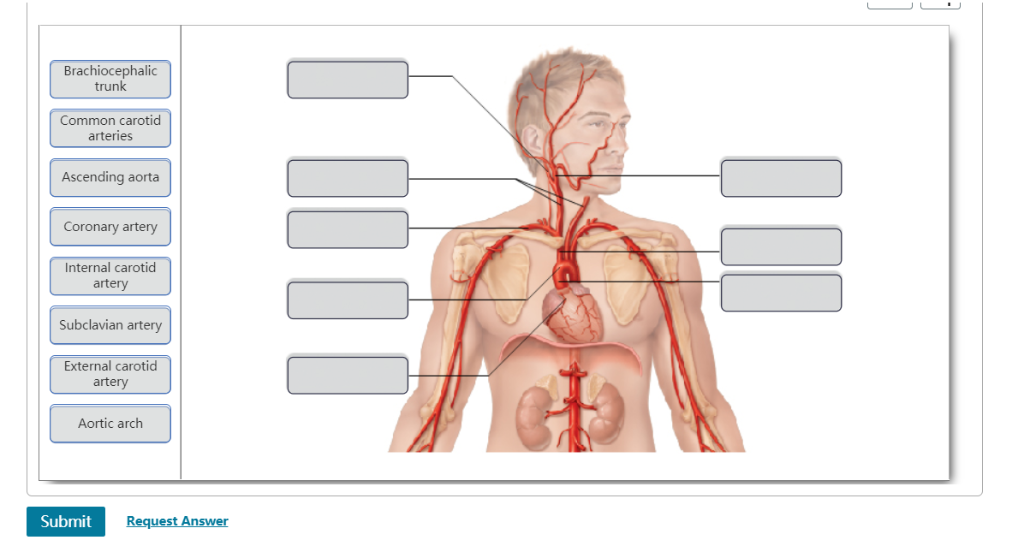 Solved Brachiocephalic trunk Common carotid arteries | Chegg.com