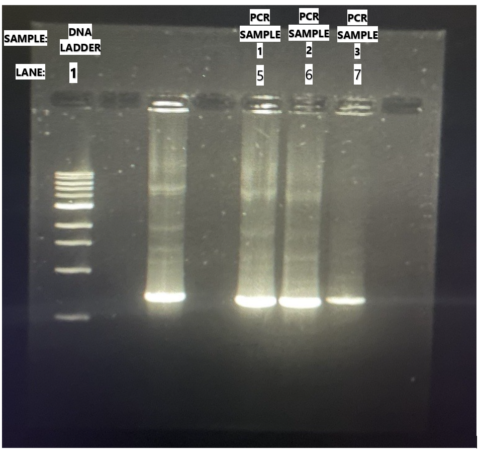 Solved Lane 1: 150ng NEB 1 ﻿kb DNA ladder | Chegg.com