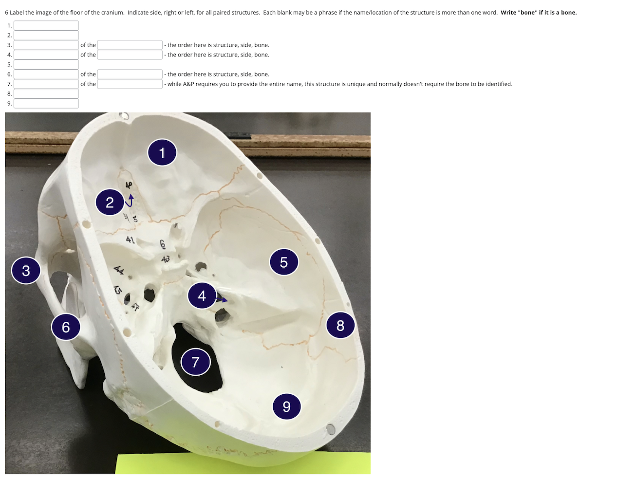 Solved Label the images 1-9 ﻿of the floor of the cranium. | Chegg.com