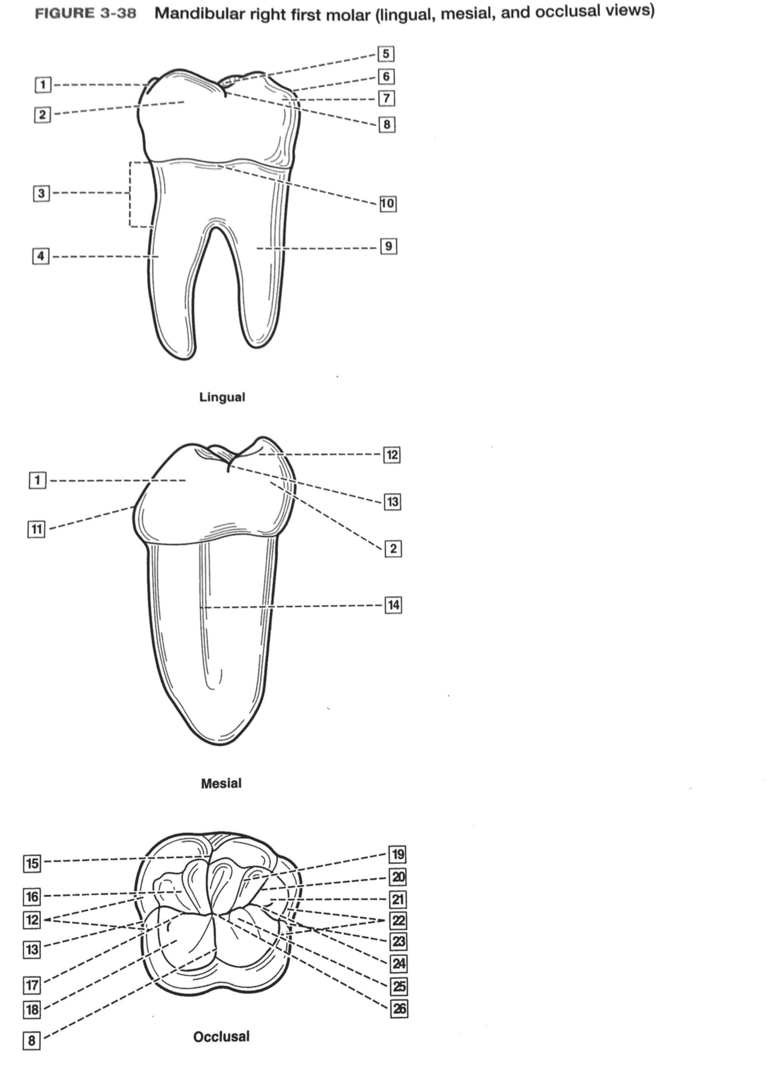 Solved dental anatomy please Mandibular right first molar | Chegg.com