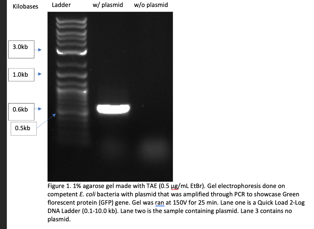 Solved Kilobases Ladder w/ plasmid w/o plasmid 3.0kb 1.Okb | Chegg.com