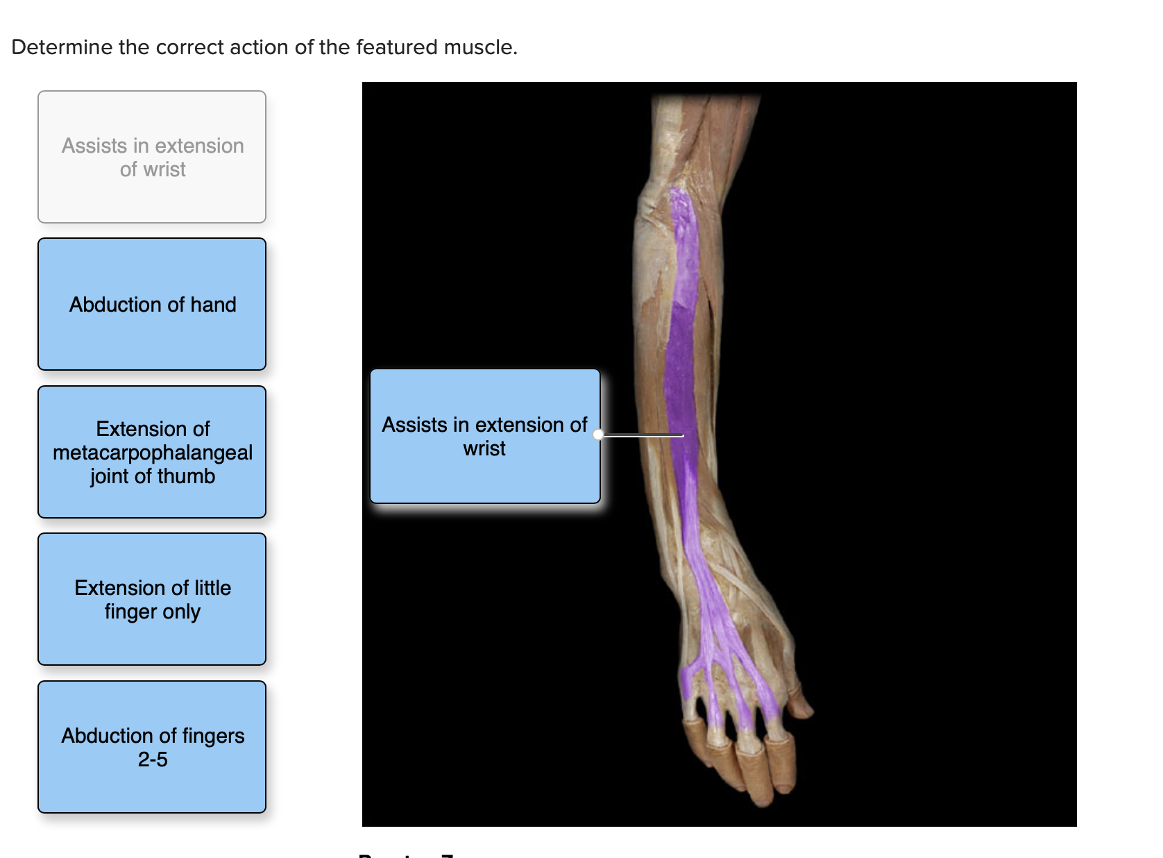 Solved Determine the correct action of the featured muscle. | Chegg.com