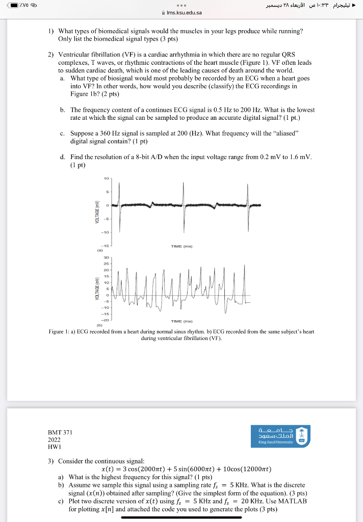 Solved 1) What types of biomedical signals would the muscles | Chegg.com