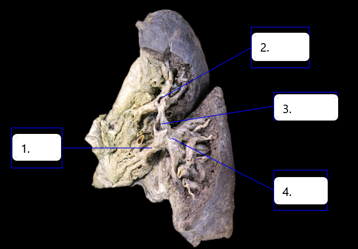 Solved label the bronchus intermedius, middle lobar | Chegg.com