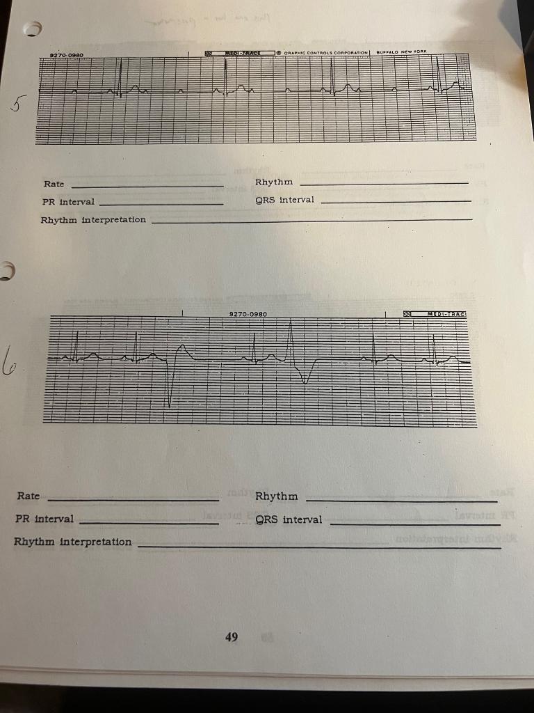 Solved PR interval QRS Interval Rhythm interpretation Rate | Chegg.com