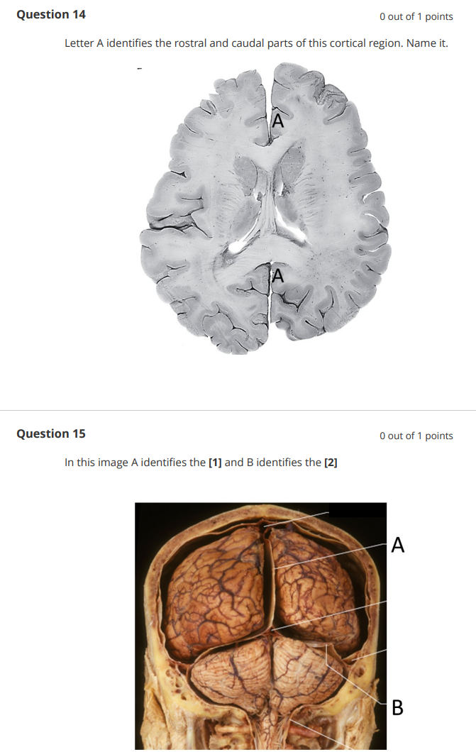 Solved Question 14 0 out of 1 points Letter A identifies the | Chegg.com