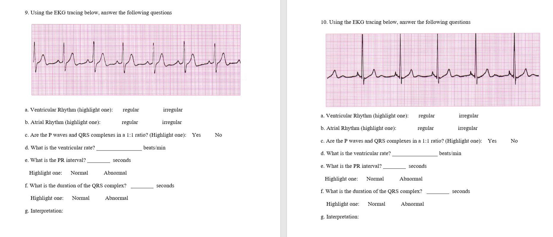 Solved 9. Using the EKG tracing below, answer the following | Chegg.com