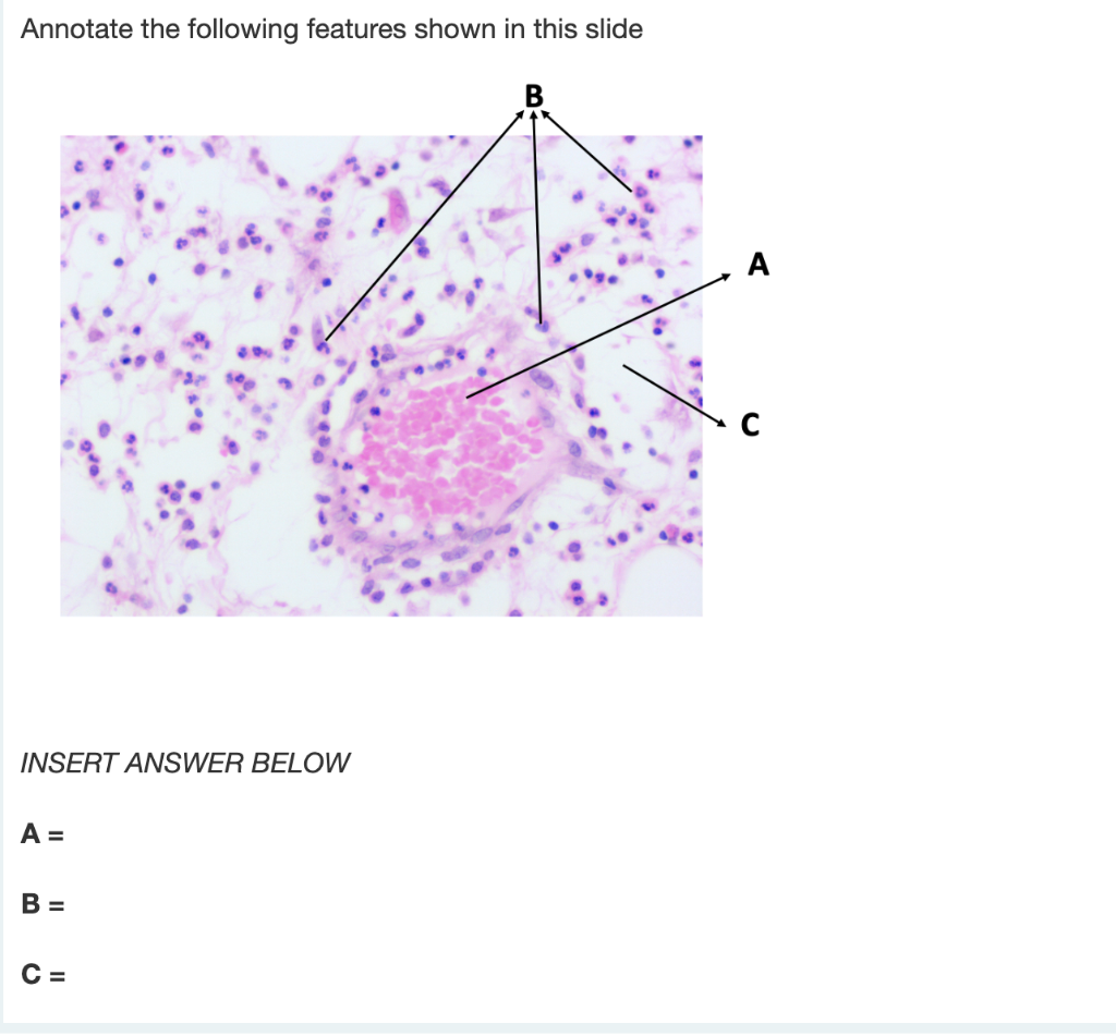 Solved Annotate the following features shown in this slide | Chegg.com