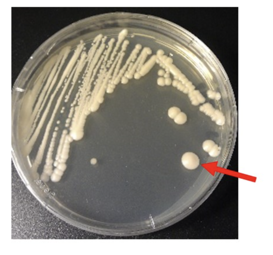 Solved 8Above is a picture of a bacterial colony (see arrow) | Chegg.com