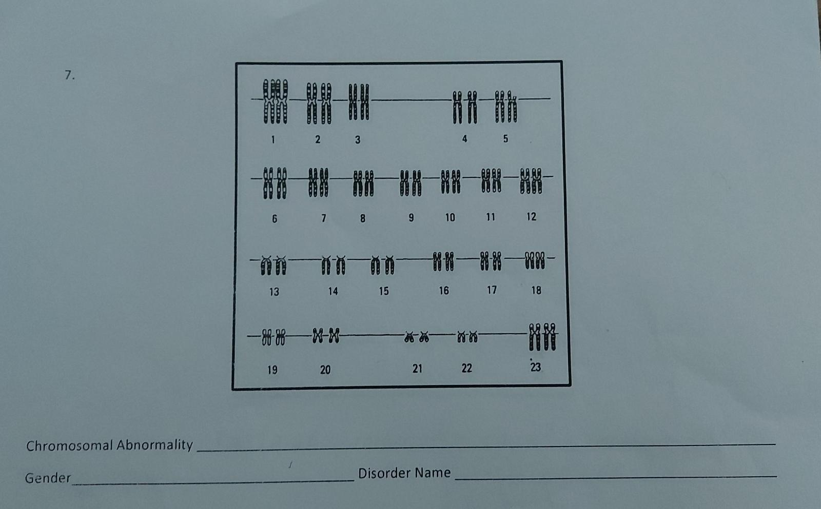 Solved Identify the abnormalities and disorder name from the | Chegg.com