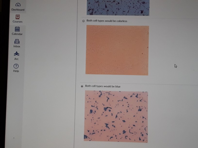 Solved Question 2 You INCORRECTLY perform an acid-fast stain | Chegg.com Solved Question 2 You INCORRECTLY perform an acid-fast stain | Chegg.com