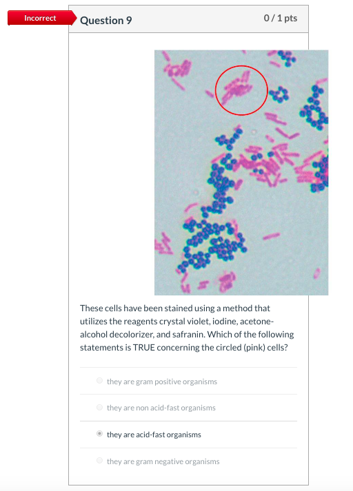 Solved Incorrect Question 9 0/1 pts These cells have been | Chegg.com Solved Incorrect Question 9 0/1 pts These cells have been | Chegg.com