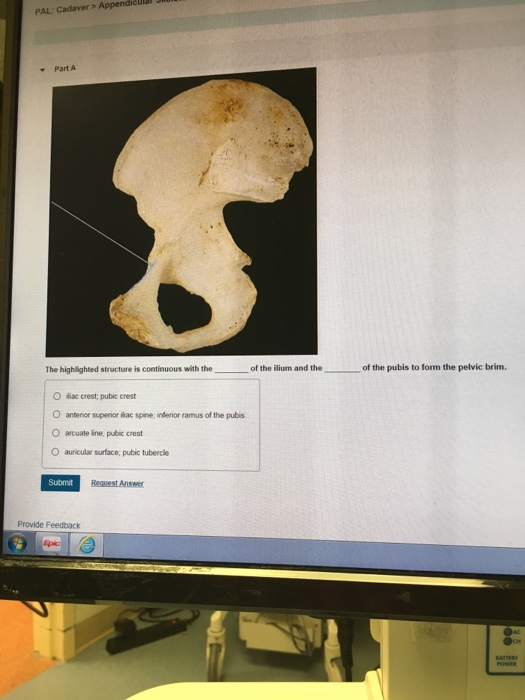 Solved PAL: Cadaver > Ap Part A The highlighted structure is | Chegg.com
