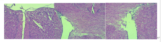 Mice brain H&E staining H&E staining | Chegg.com