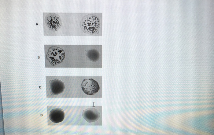 Solved Which is type O, A, AB, B, Universal donor, universal | Chegg.com