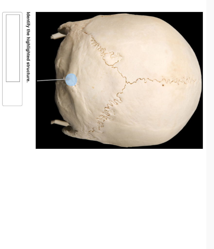 Solved Identify the highlighted structure.Identify the | Chegg.com