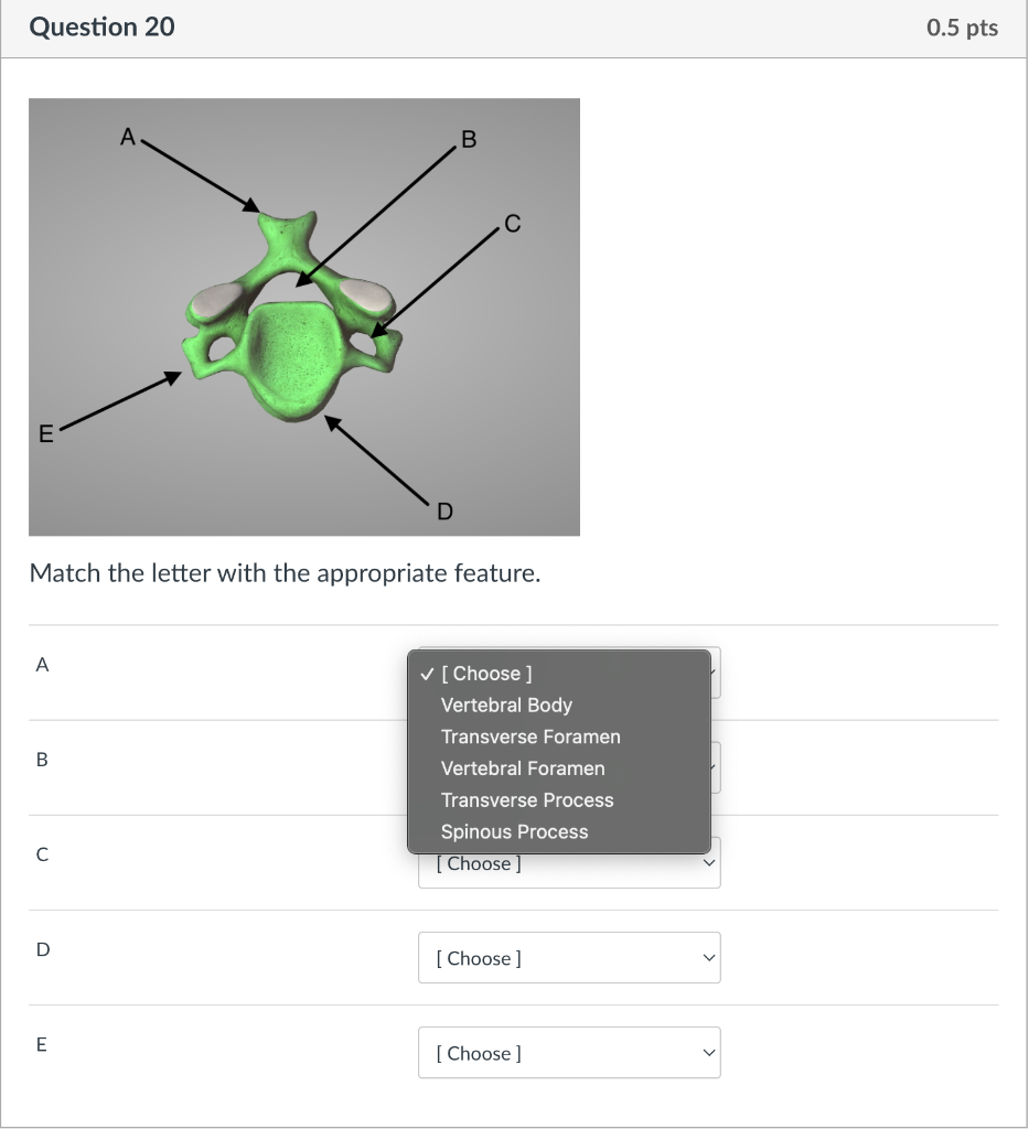 Solved Name the feature that is highlighted Manubrium | Chegg.com