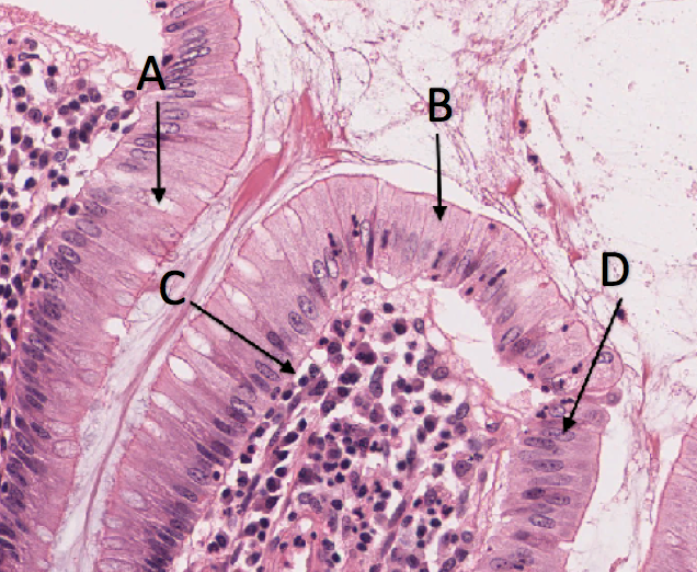 Solved Four BASIC tissue types · Epithelial · | Chegg.com