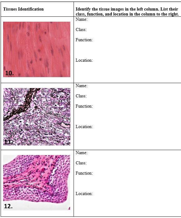 Solved \begin{tabular}{|l|l|} \hline Tissues Identification | Chegg.com