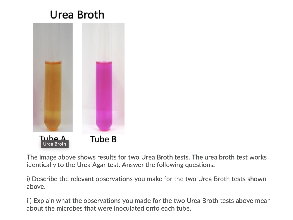 Solved Urea Broth Tube A Urea Broth Tube B The image above | Chegg.com