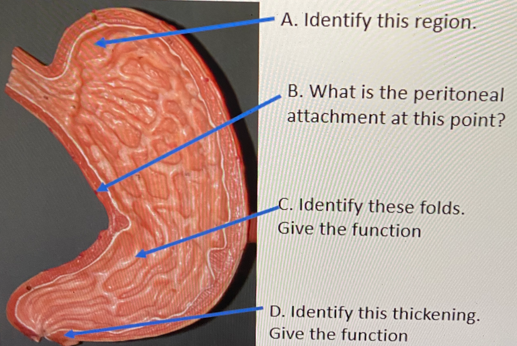 Solved A. Identify this region. B. What is the peritoneal | Chegg.com