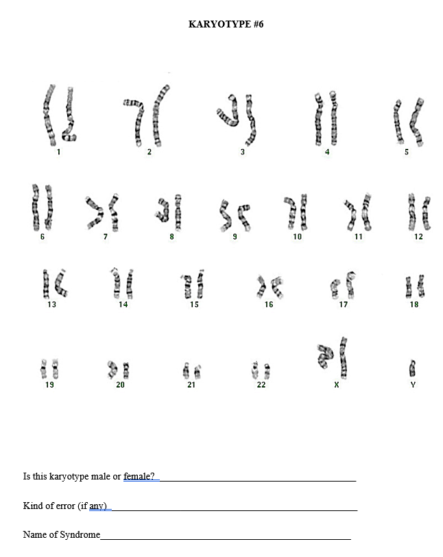 Solved Is this karyotype male or female? Kind of error (if | Chegg.com