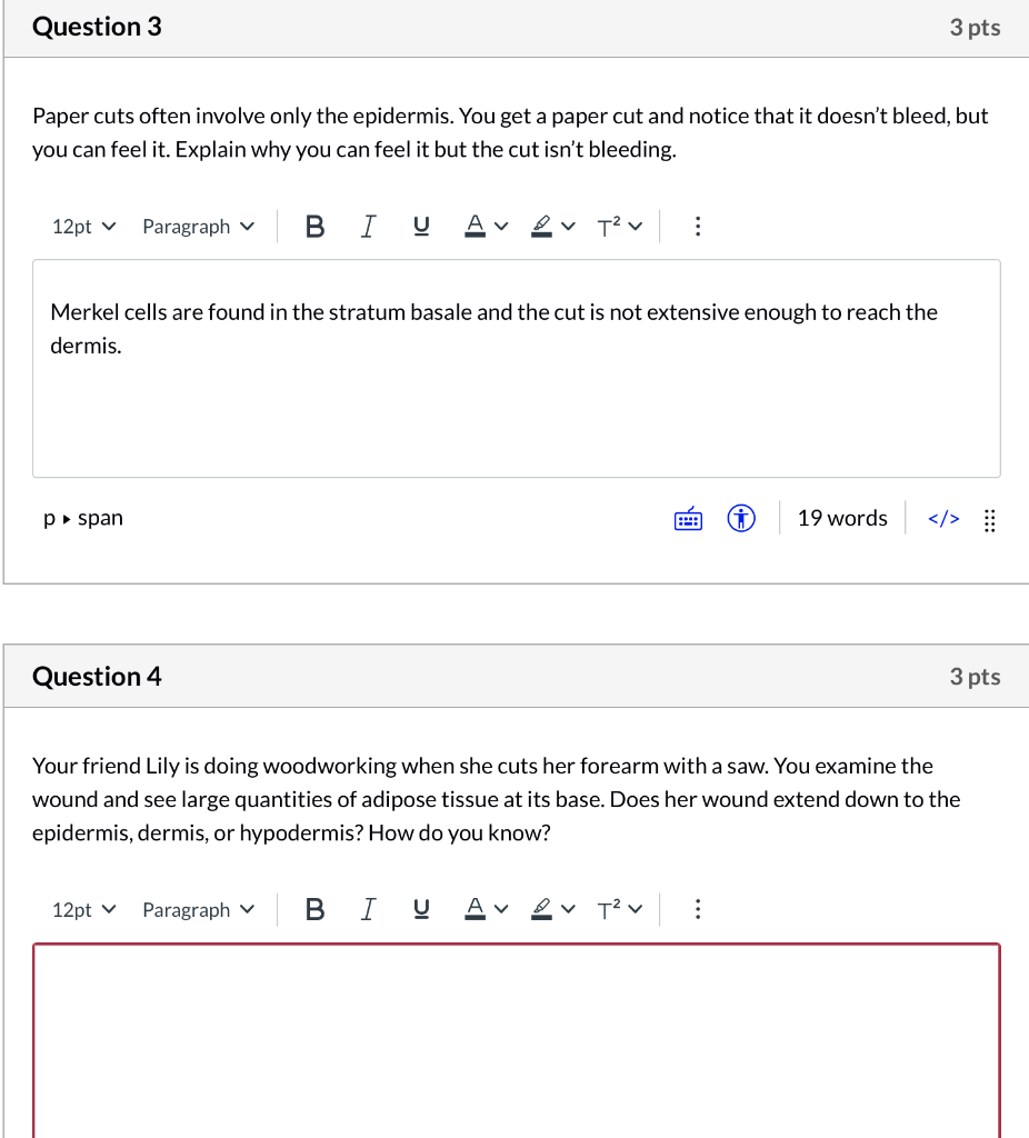 Solved Question 3 3 pts Paper cuts often involve only the | Chegg.com