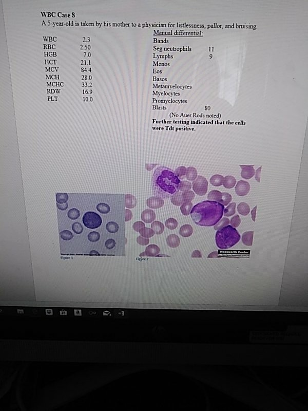 Solved Hematology Techniques lI WBC Case Study Questions WBC | Chegg.com