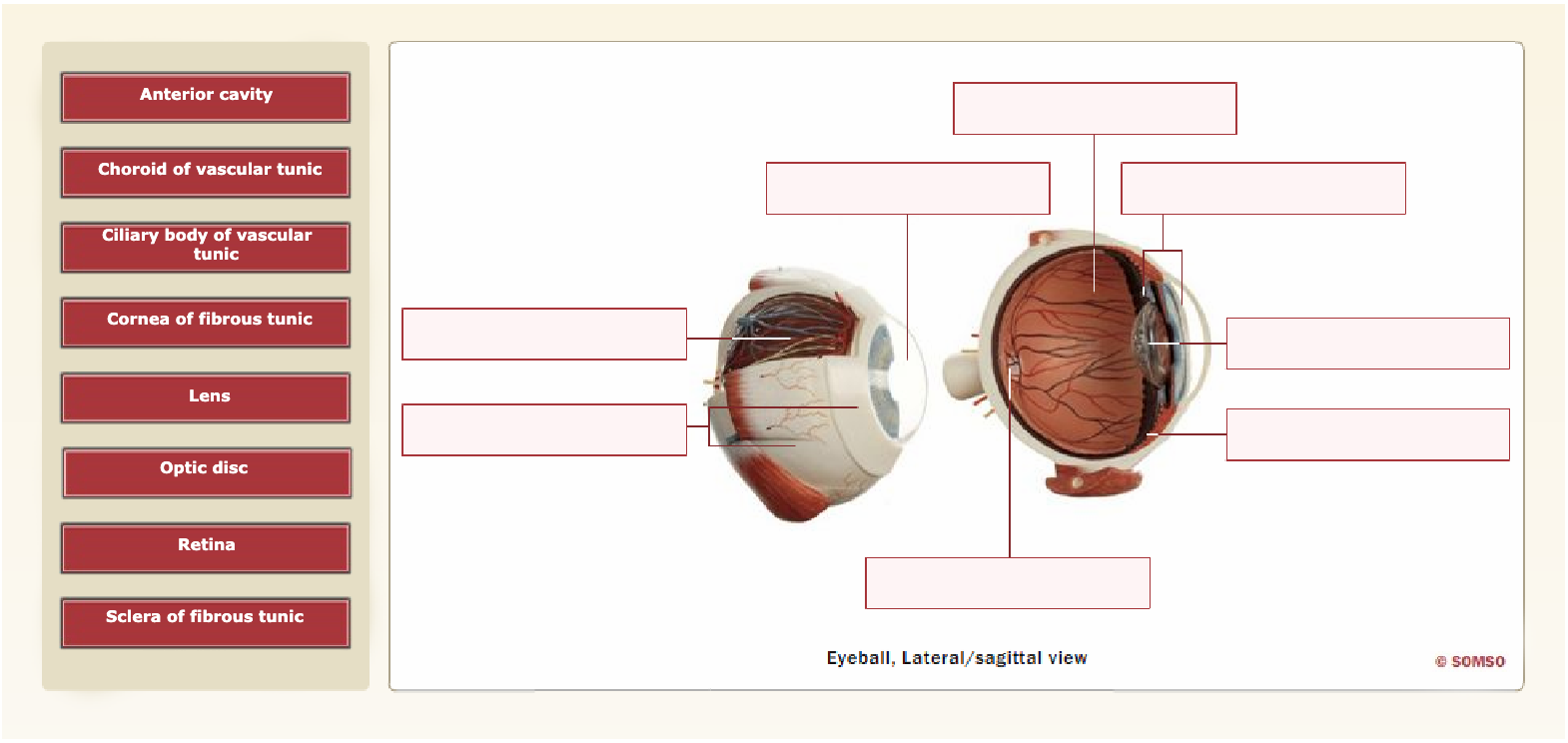 Solved Anterior cavity Choroid of vascular tunic Ciliary | Chegg.com
