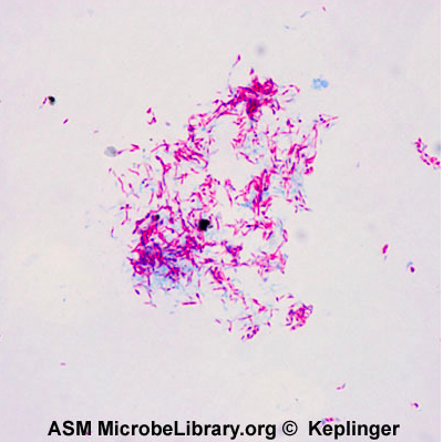 Solved To ts ASM MicrobeLibrary.org © Keplinger ASM | Chegg.com