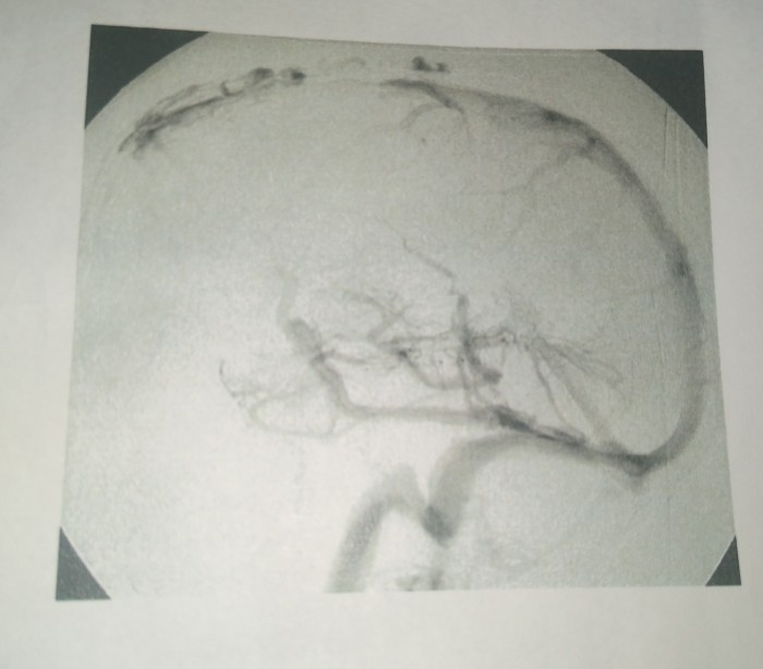 Solved Is the image to the RIGHT an angiogram or venogram? | Chegg.com