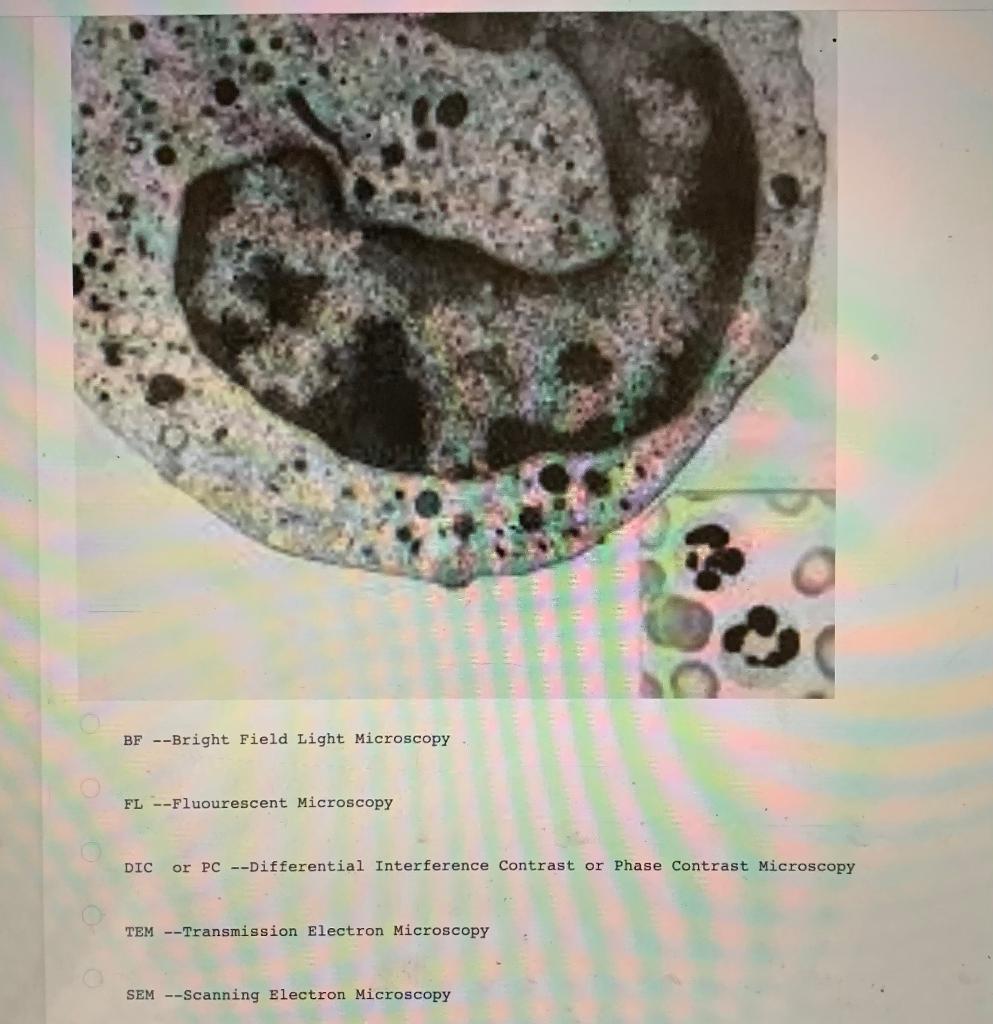 Solved Examine this micrograph examining the synapse between | Chegg.com
