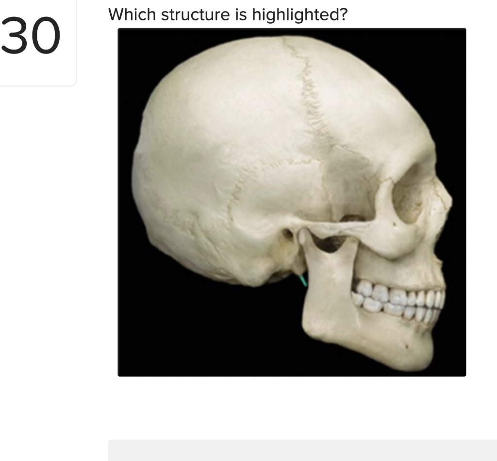 Solved Which structure is highlighted? Multiple Choice | Chegg.com
