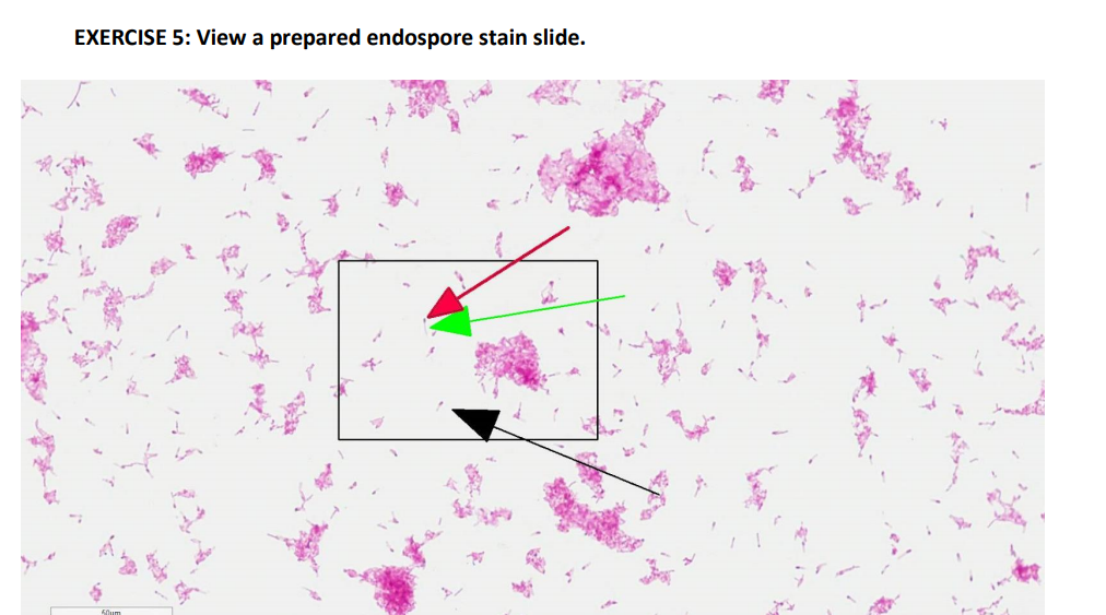 Solved EXERCISE 5: View a prepared endospore stain slide. | Chegg.com