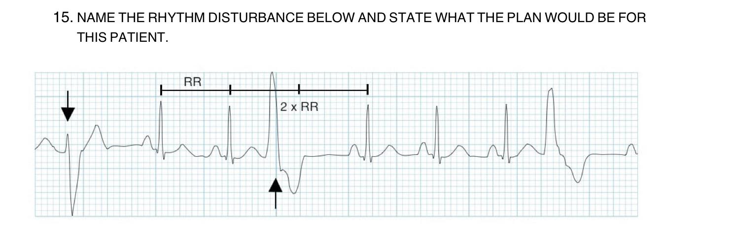 Solved 15. NAME THE RHYTHM DISTURBANCE BELOW AND STATE WHAT | Chegg.com