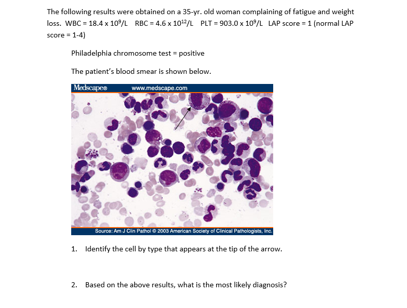 Solved The following results were obtained on a 35-yr. old | Chegg.com