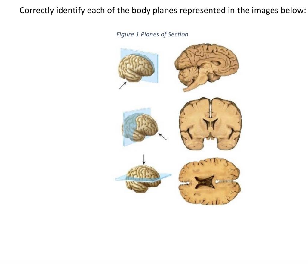 Solved Correctly identify each of the body planes | Chegg.com