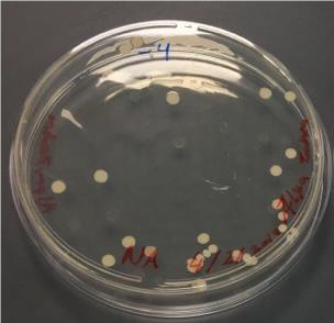 Solved These two plates were made using streak plate method | Chegg.com