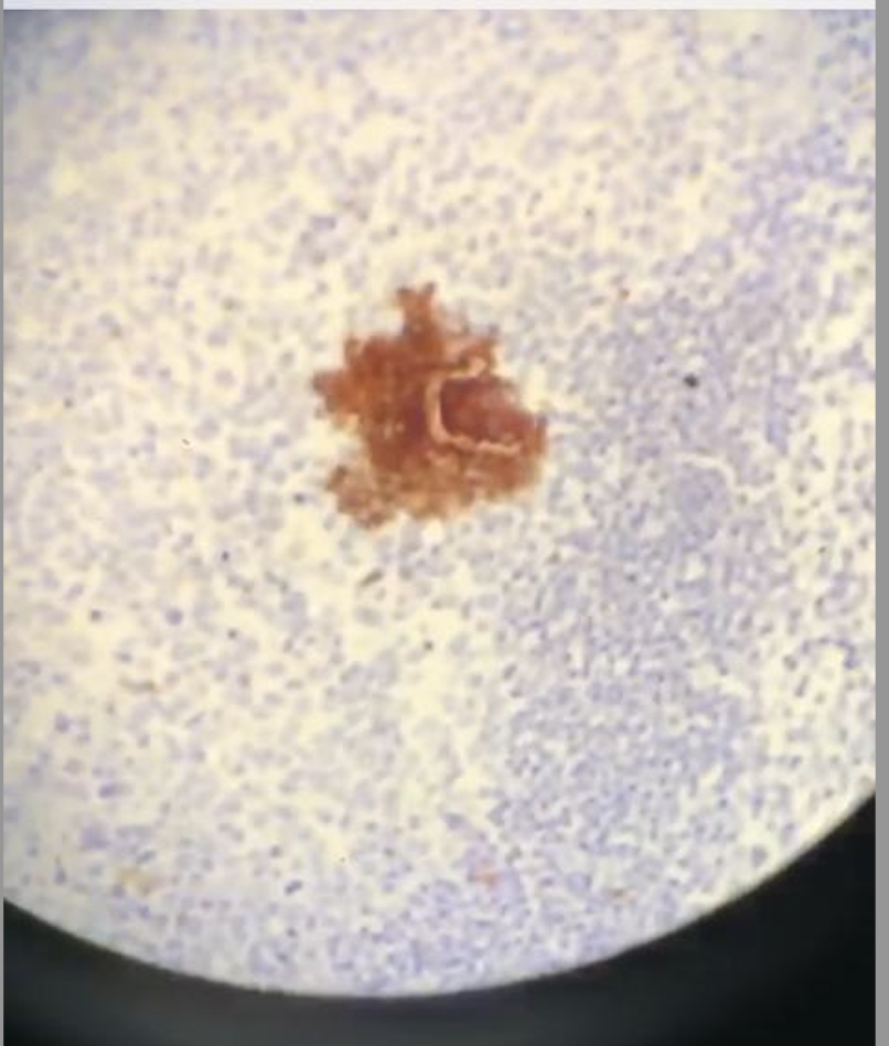 By looking at these images obtained under the | Chegg.com