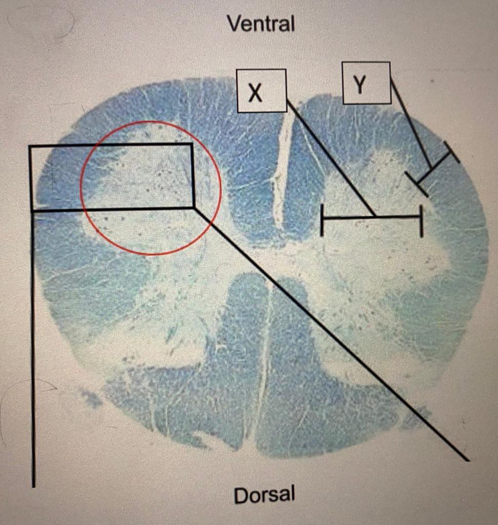 Solved 1. Name the two cellular extensions projecting from | Chegg.com
