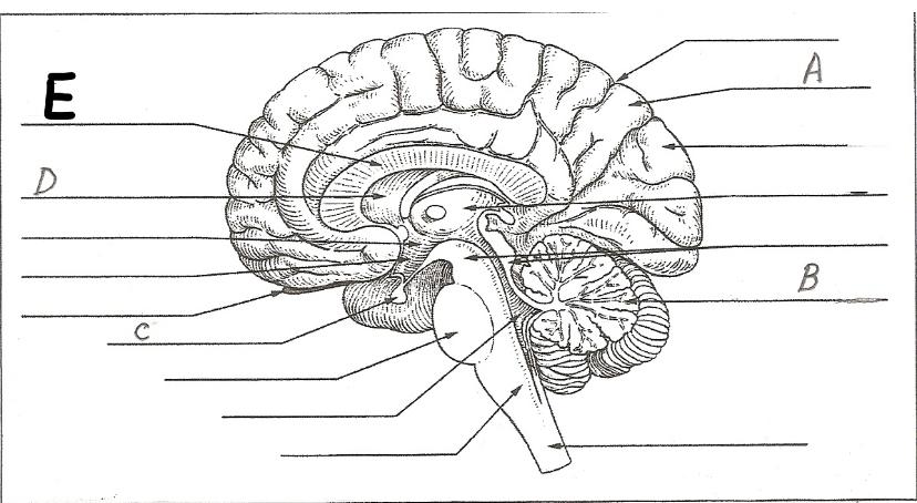 Solved consists of identifying the five brain structures | Chegg.com