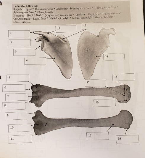 Solved Label the following: Scapuln Spine Coracoid process | Chegg.com