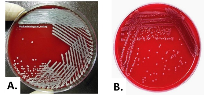 Solved You inoculate two different nutrient broth (NB) tubes | Chegg.com