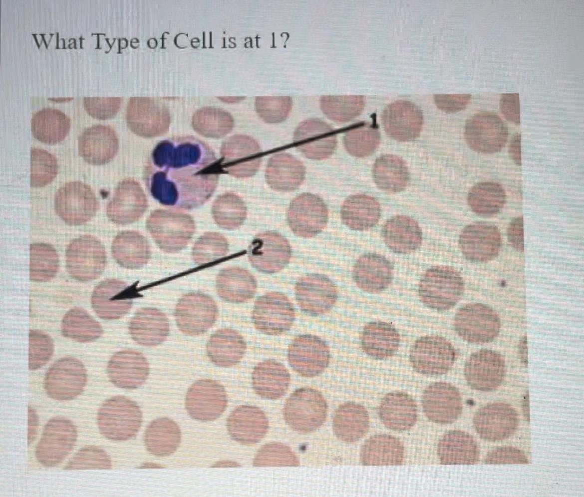 Solved What Type of Cell is at 1 ? | Chegg.com