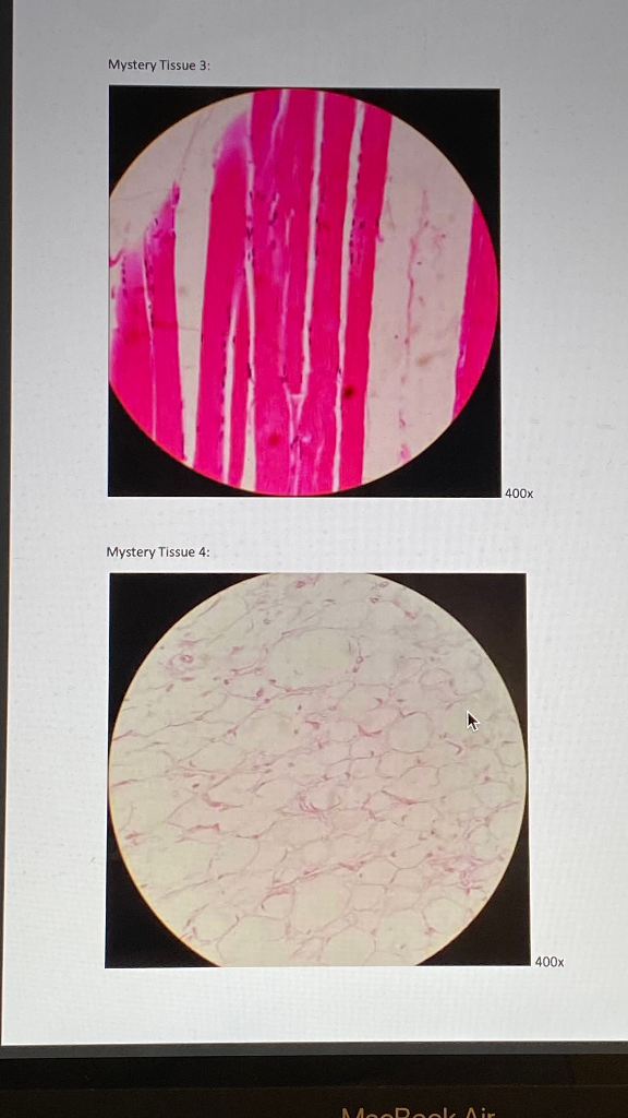Smooth Muscle Tissue Slide 400x