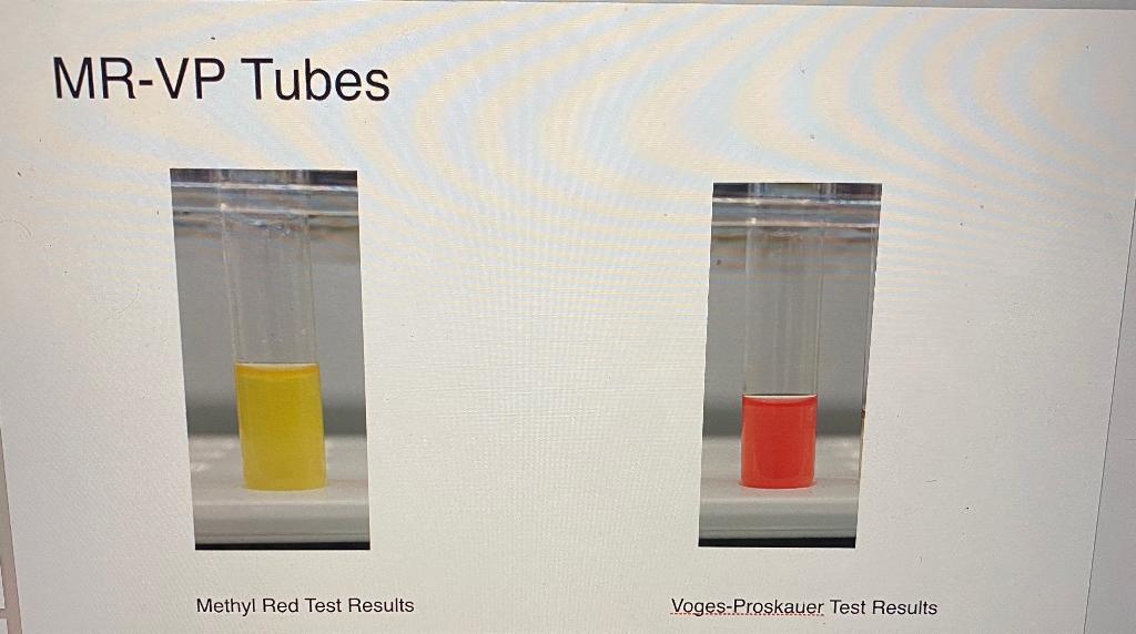 Solved MR-VP Tubes Methyl Red Test Results Voges-Proskauer | Chegg.com