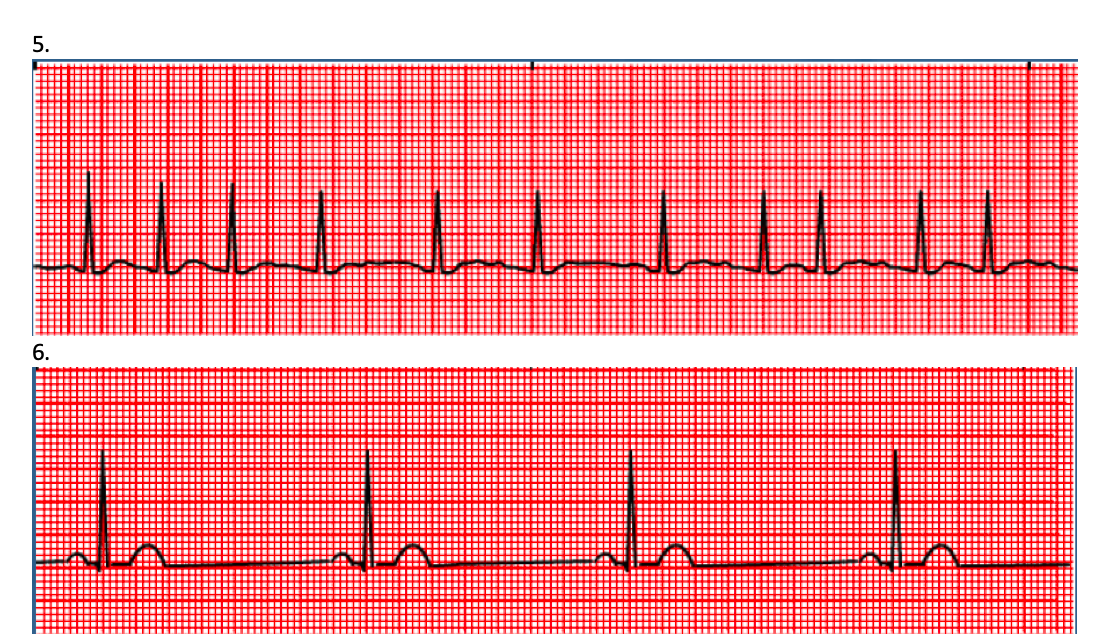 Solved Identify each rhythm and try to identify the | Chegg.com