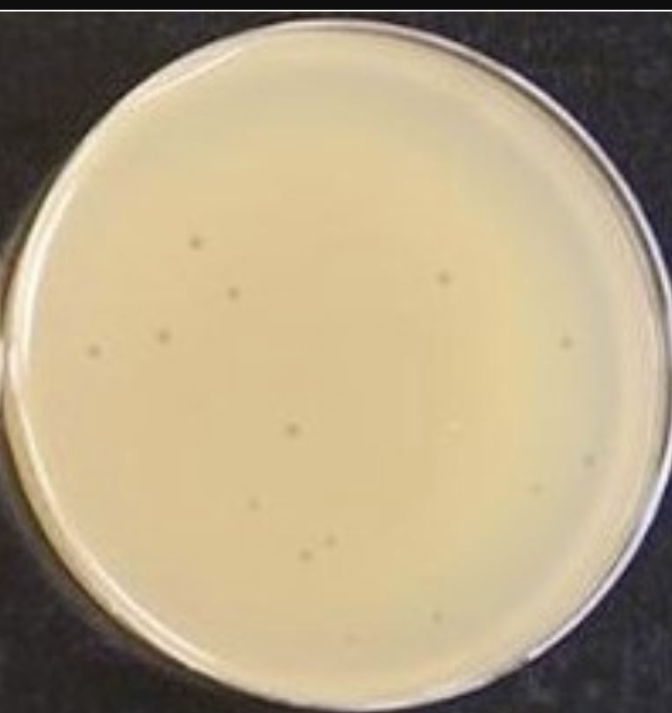 Solved The plate below was inoculated with 1 mL of broth | Chegg.com