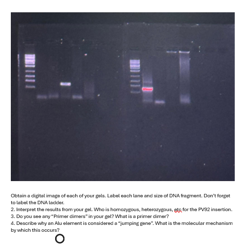Solved 1. ﻿Obtain a digital image of each of your gels. | Chegg.com